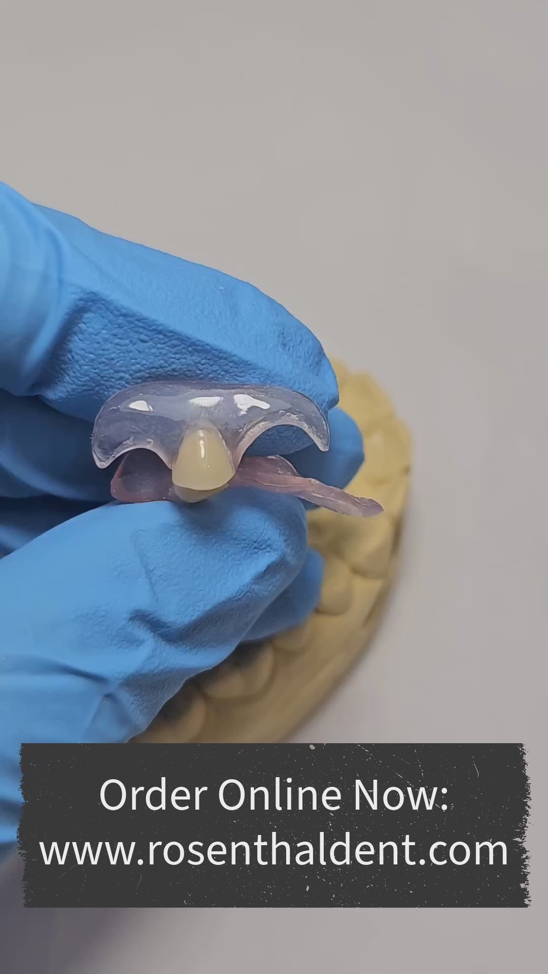 Flexible Nesbit Flipper Denture – 1–3 Tooth Partial | Order Online