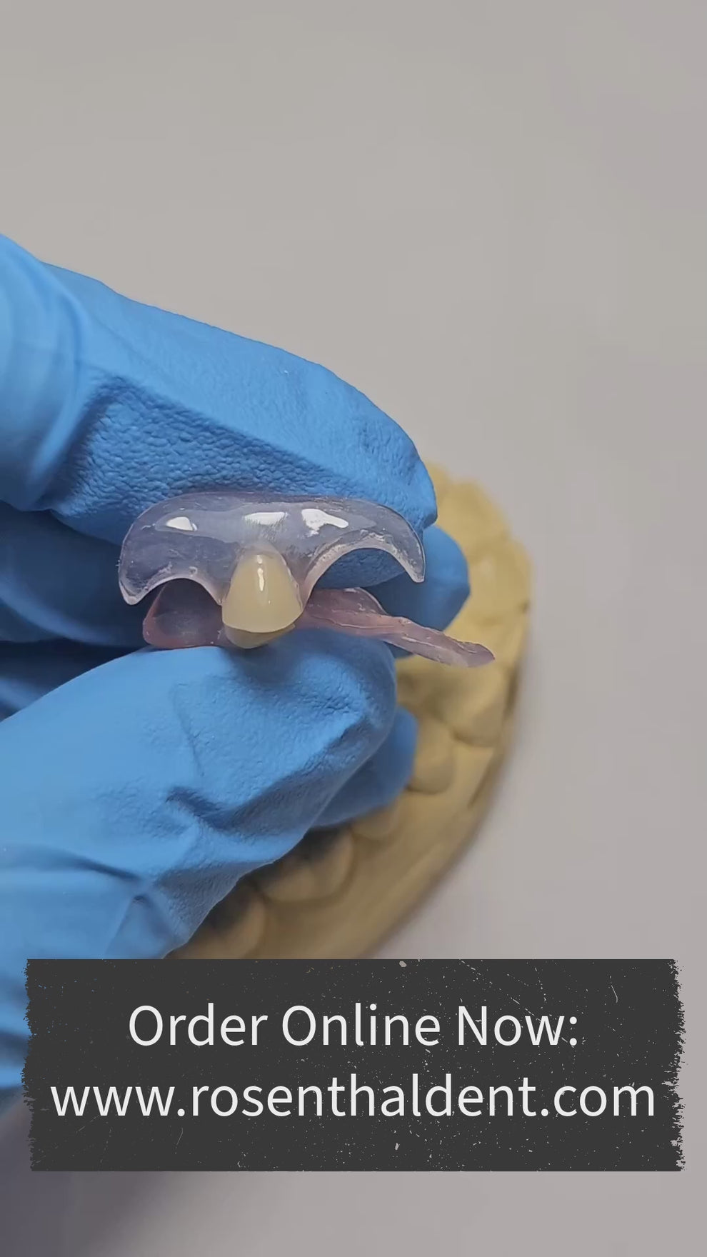 Flexible Nesbit Flipper Denture – 1–3 Tooth Partial | Order Online